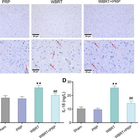 Platelet Rich Plasma Inhibits The Levels Of Microglia And Download