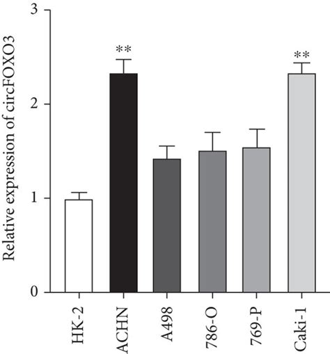 Expression And Characterization Of Circfoxo3 In Ccrcc A Qrt Pcr Was