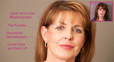 High Vs Low Cheekbones How Do You Know