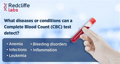 Cbc Test Price Normal Range Preparation And Process 2025