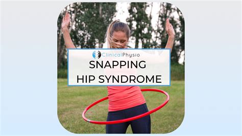 Snapping Hip Syndrome Clinical Physio Membership