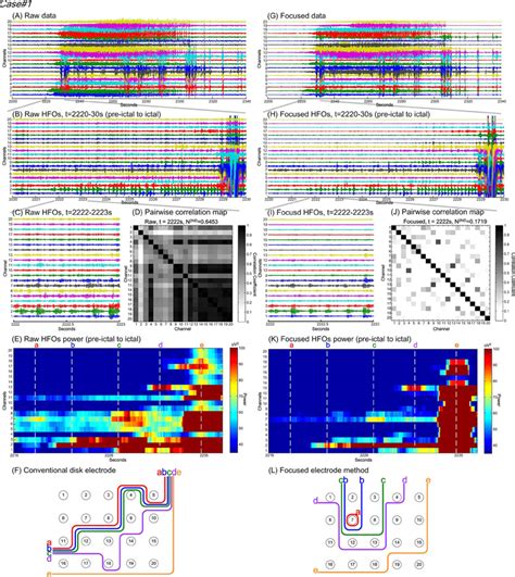 a spatially focused method for high density electrode based functional