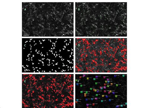 Visualization Of Outputs Of Different Segmentation Methods A Original Download Scientific