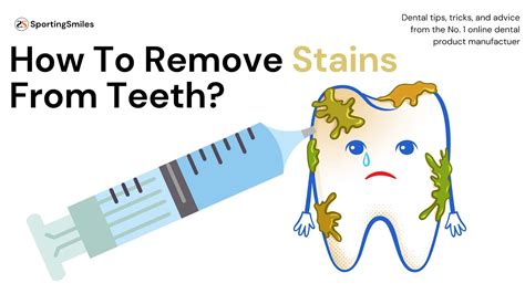 How To Remove Stains From Teeth Youtube