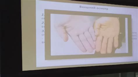 Лекция по пропедевтике Заболевания печени Youtube