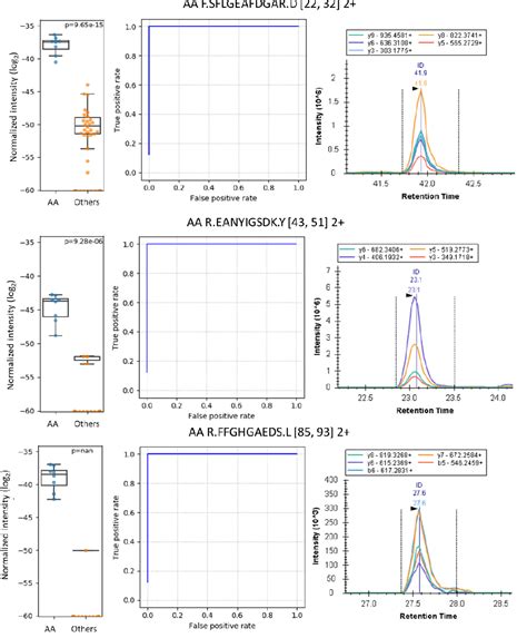 Figure 3 7 From Development Of Amyloidosis Typing Method And Data