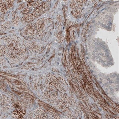 Laminin Alpha 4 Monoclonal Antibody Cl3183 Invitrogen™ 100 μl