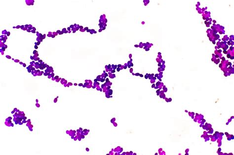 Candida Intestinala Cauze Simptome Tratament Dr Max
