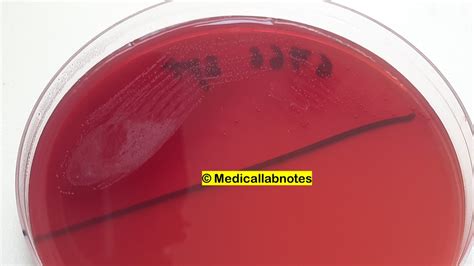 Streptococcus Oralisintroduction Morphology Pathogenicity