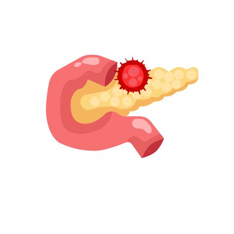 Pancreatic Cancer Projects Center For Surgical Science Css