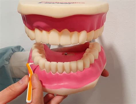 Todo Lo Que Debes Saber De Los Cepillos Interdentales Dental Galindo