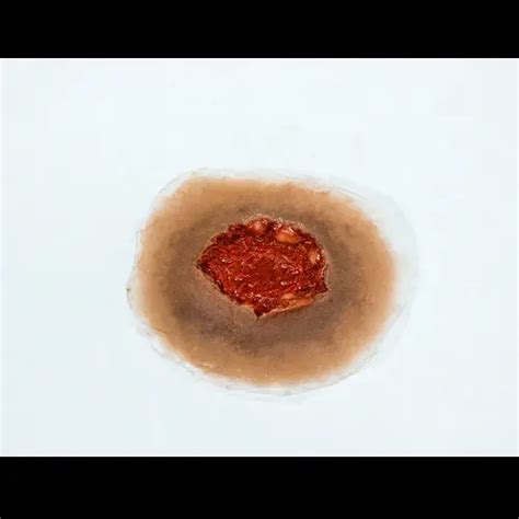 GS Exit Wound Large Joint Force Tactical