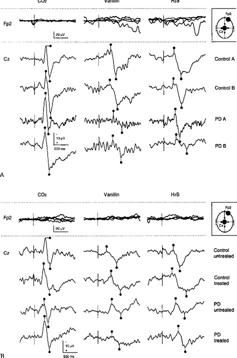Figure 1 From Chemosensory Event Related Potentials In Response To