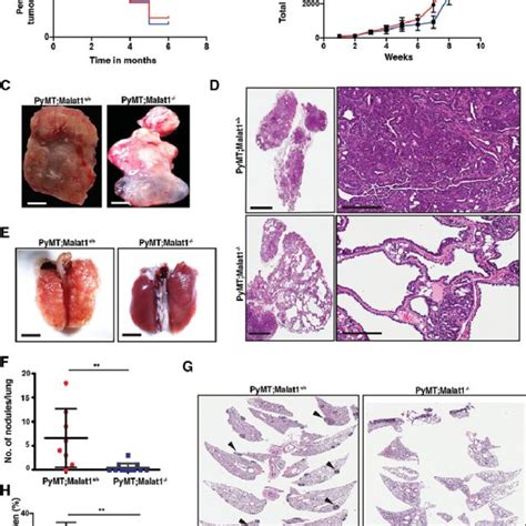 Lung Metastasis Is Impaired In Malat1 Knockdown Mice A Download