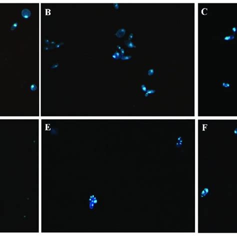 Fluorescence Microscopy Pictures Depicting The Changes On The Nucleus