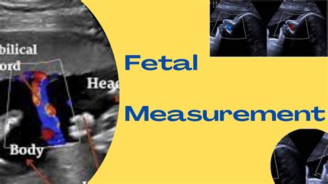 Fetal Measurements Fetal Biometry Basic Fetal Ultrasound