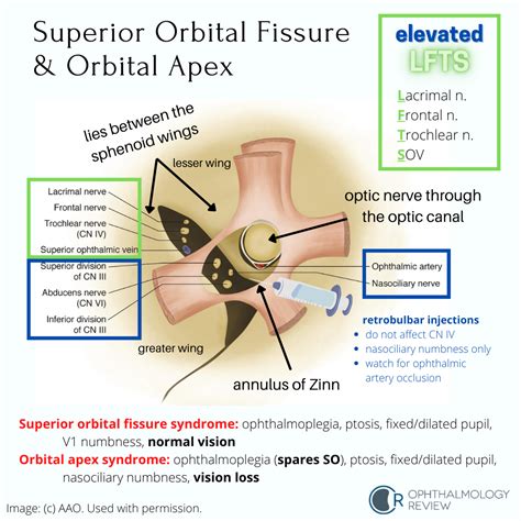 Superior Orbital Fissure And Orbital Apex — Ophthalmology Review