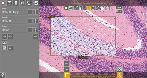 Microscope Annotation Software Augmentiqs