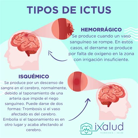 Secuelas Tras Sufrir Un Ictus Ixaludes