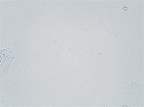 Urine Sediment Detection Object Detection Model By Object Detection