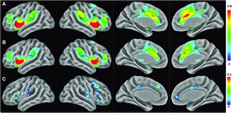 Resting State Functional Connectivity Networks Of The Anterior Insula