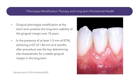 periodontal peri implant soft tissue phenotype pdf