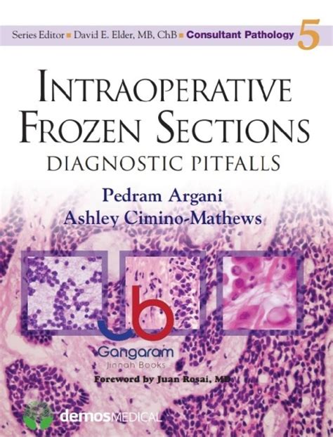 Intraoperative Frozen Sections Diagnostic Pitfalls 1st Edition