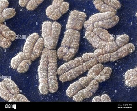 Group Of Human Chromosomes Coloured Scanning Electron Micrograph Sem Magnification X7000 At