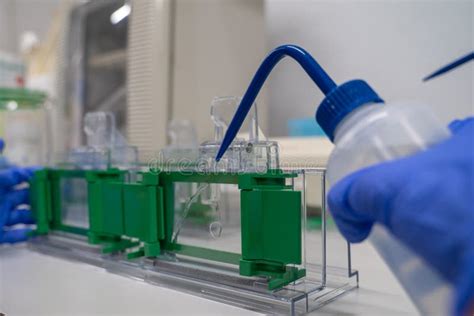 The General Process Preparation For Protein Levels Detection Is Using Western Blot Analysis