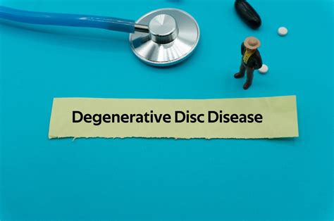 Understanding Your Role In Degenerative Disc Disease Treatment Plans
