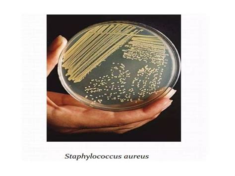 Staphylococcus Aureus2013 Ppt