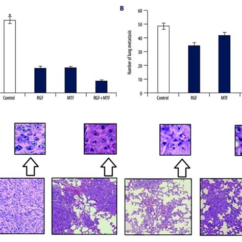 Tumor Growth And Its Relapse Were Suppressed After Administration With