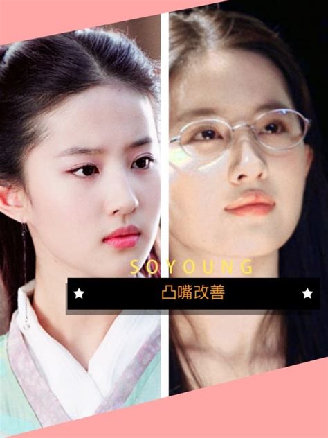 嘴凸的明星们侧脸图片嘴凸的女明星 伤感说说吧