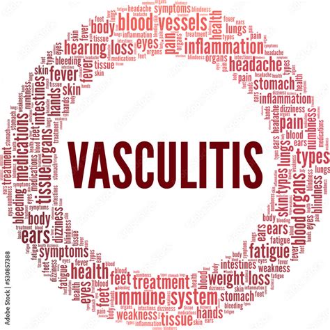 Vasculitis Word Cloud Conceptual Design Isolated On White Background