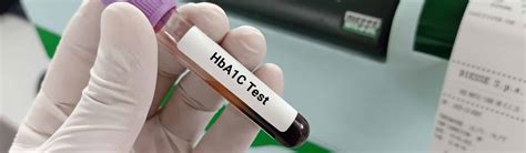 A1c Test Insulinic Of Florida A1c Testing Center
