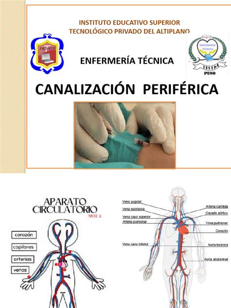 Canalización Periférica Enfermería Técnica Pdf Terapia Intravenosa