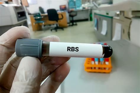 기술자 또는 과학자는 무작위 혈당 테스트의 샘플 튜브를 개최 의료 테스트 개념 Stem 주제에 대한 스톡 사진 및 기타 이미지