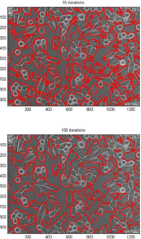 Figure 14 From Segmentation Of Microscopic Images Using Level Set Methods Semantic Scholar
