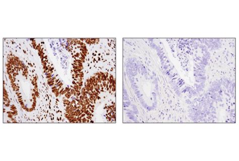 Acetyl Histone H2b Lys20 D7o9w Rabbit Mab Cell Signaling Technology