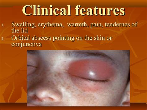Orbital Inflammation
