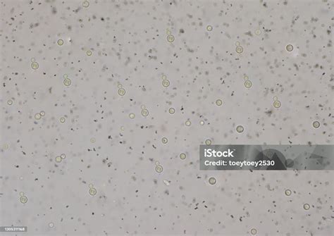 Cryptococcus Neoformans Is An Encapsulated Fungal Organism And It Can Cause Disease In