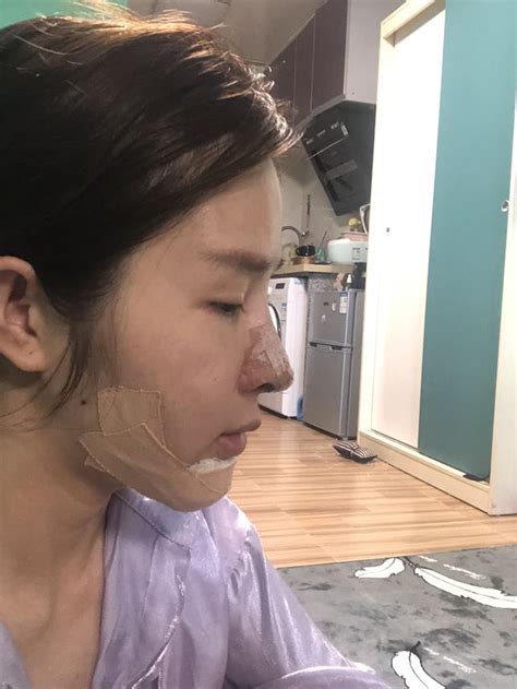 村姑秒變女神，女子只因做了鼻子和下巴，閨蜜說換了個人 每日頭條