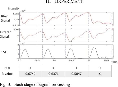 Figure 1 From Non Invasive Spo2 Monitoring Using Reflective Ppg A Low Cost Calibration Method
