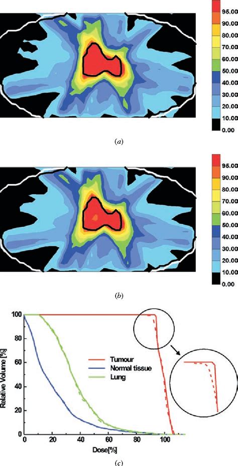 Figure 2 From The Effect Of Statistical Uncertainty On Inverse Treatment Planning Based On Monte