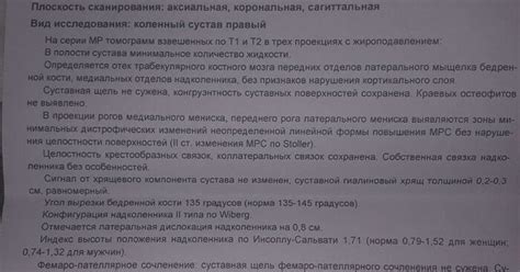 Вывих коленного сустава Пикабу