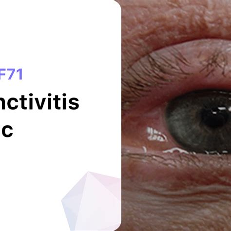 Conjunctivitis Allergic Icpc 2 F71