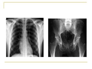 Introduction RADIOLOGY Ppt Medical Tests Medical Health