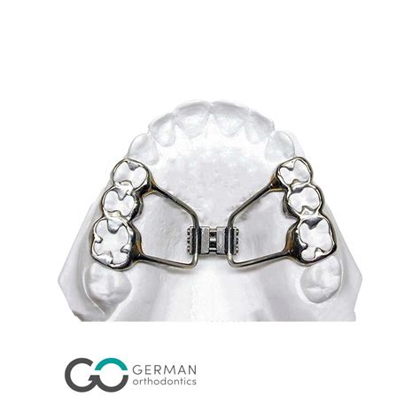Rapid Palatal Expansion Rpe German Orthodontics