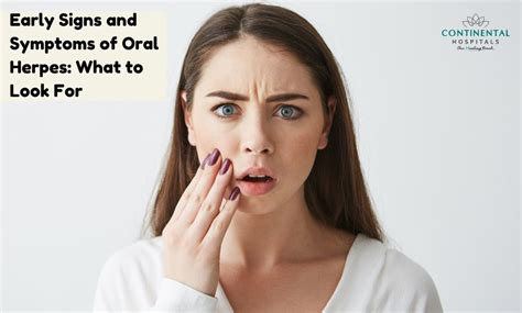 Early Signs And Symptoms Of Oral Herpes What To Look For