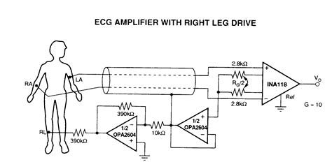 Simple Ecg Circuit Schematic